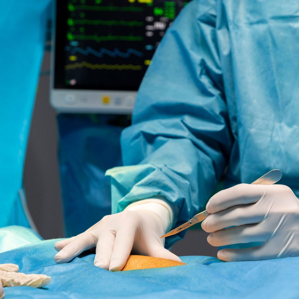 Markó Medical | Bőralatti elváltozás műtéte (Debrecen) - Markó Medical